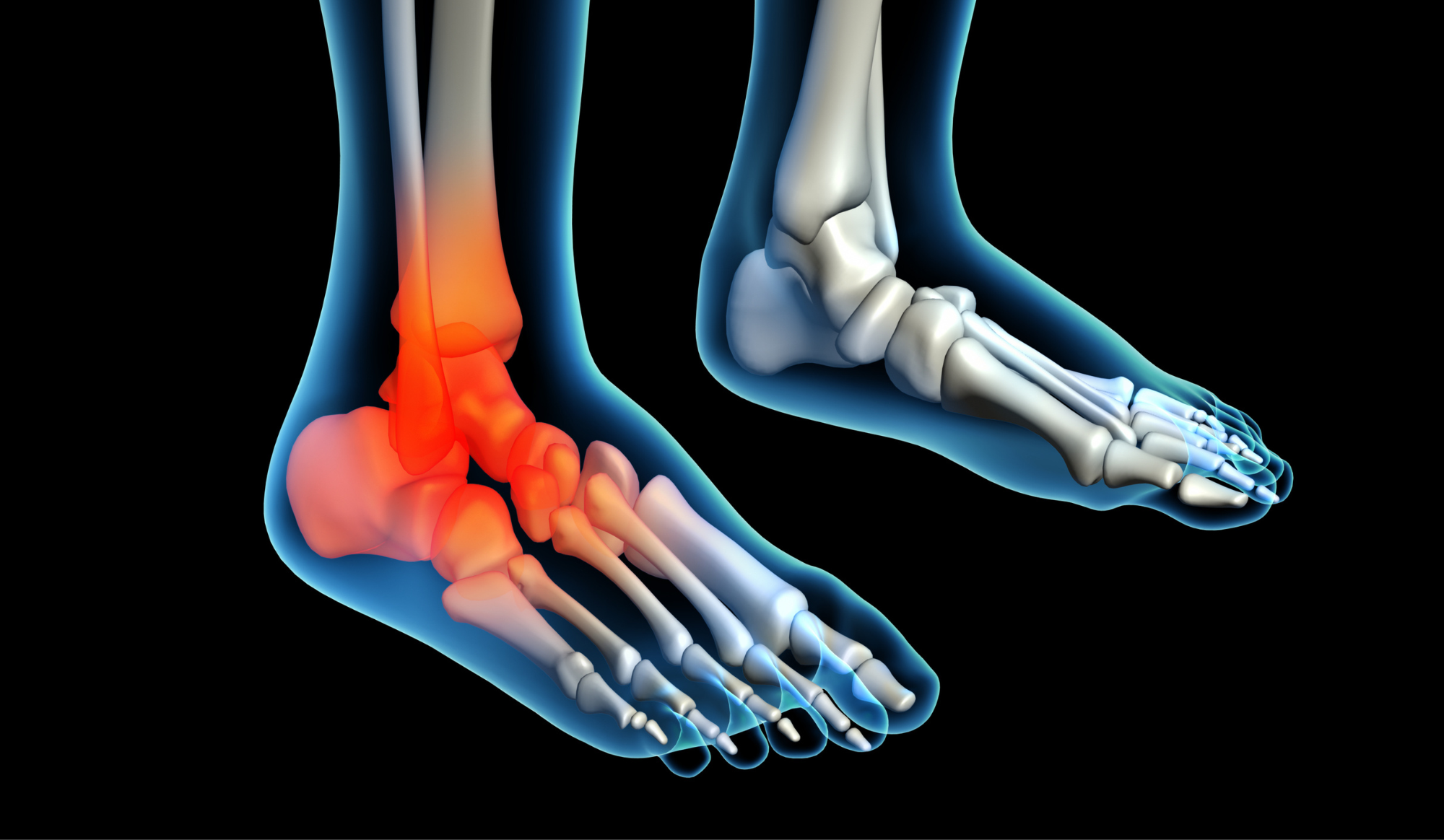 Ouch! Arthritis In Your Feet? Learn Symptoms, Causes and Treatments ...